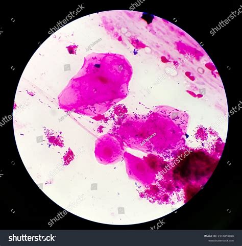Photo De Stock Cocci Gram Positif Dans La Grappe 2116859876 Shutterstock