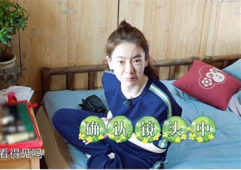 戚薇脸又肿了？连精修都拯救不了她的脸，节目中她曾透露过原因！