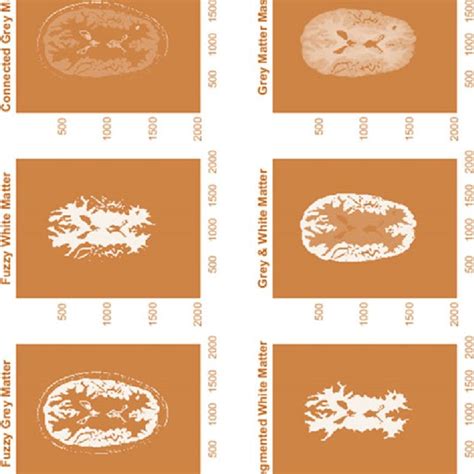 Gray And White Matter Segmentation In Brain Mri Images Download Scientific Diagram