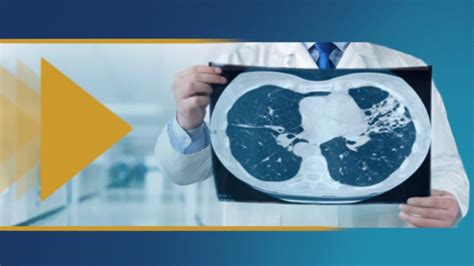 Strategies For Mycobacterium Avium Complex Infections Mycme