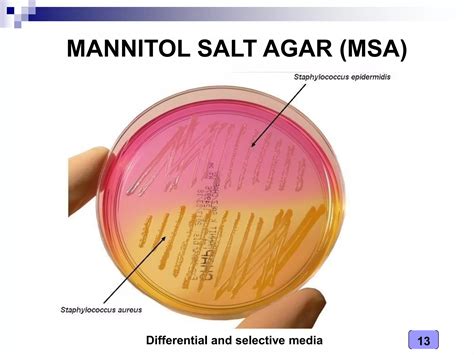 L13 Medical Microbiology Laboratory Staphylococcus Spp Ppt