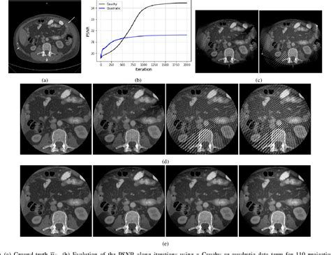 Figure 6 From Deep Unfolding Of The Dbfb Algorithm With Application To
