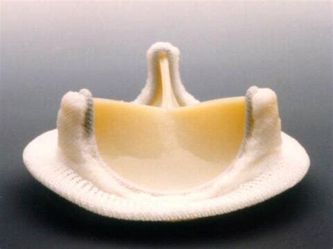 Bioprosthetic Heart Valves Heart Valve Performance Laboratory