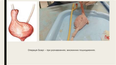 Ушкодження сечовивідних шляхів презентация онлайн