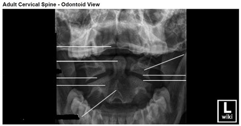 Radiology Diagram Quizlet