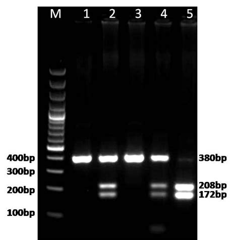 PCR RFLP Based Genotyping Of DNMT3B C46359T Lanes 1 And 3 CC Wild