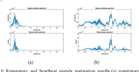 Figure From Improved Denoising Method For Uwb Vital Signs Detection