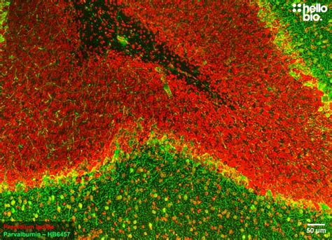 Mightymount™ Antifade Fluorescence Mounting Medium With Propidium