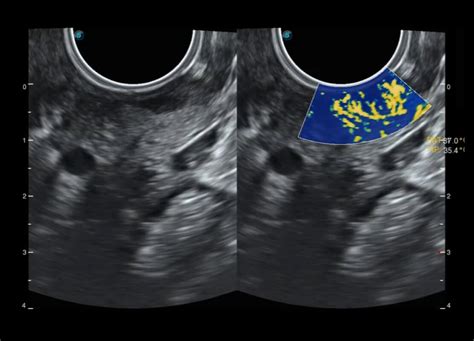 P60 Exp Colour Doppler System Innologic