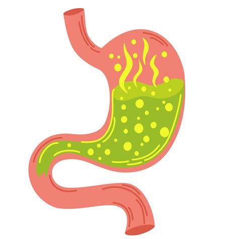 Gastroesophageal Reflux Disease Vector Art Icons And Graphics For