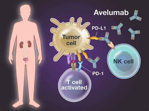 Immunotherapy For Bladder Cancer Types Success Rate Side Effects