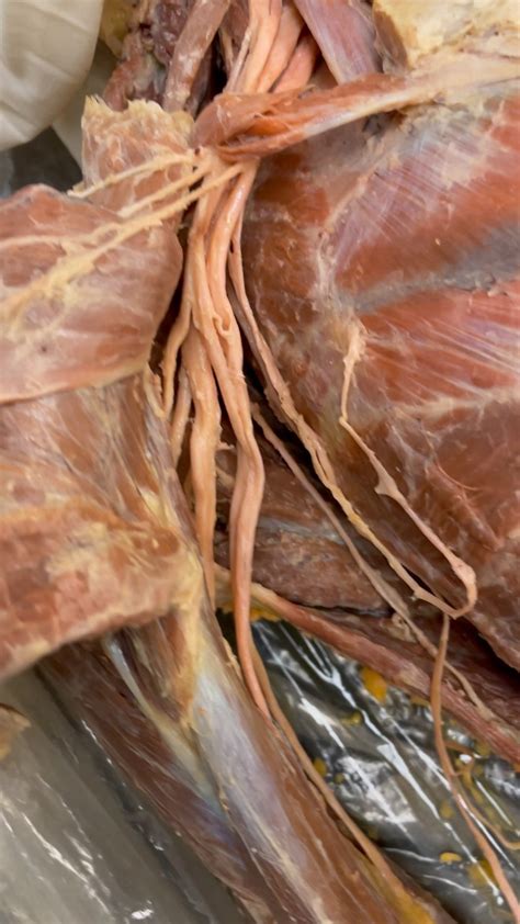 Amazing Nerves Of The Upper Limb Brachial Plexus Nerves Muscle