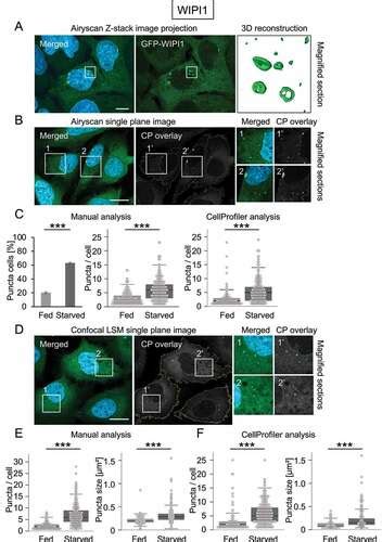 full article autophagy profiling in single cells with open source cellprofiler based image analysis