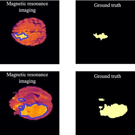 Convolutional Block Encoder Of Model 2 The Block Implements The Download Scientific Diagram