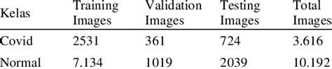 Amount Of Data Before Augmentation And Undersampling Download