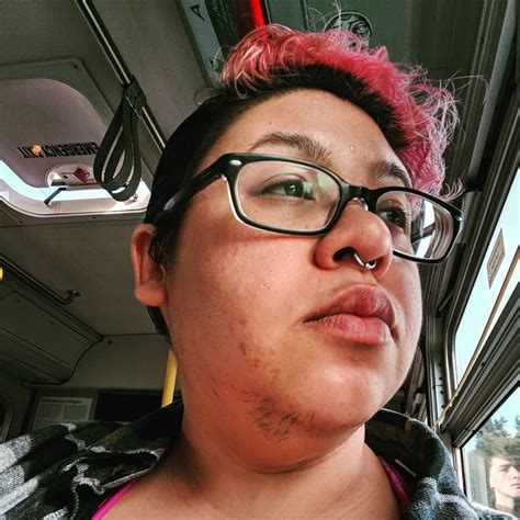 Top 110 Female Facial Hair Growth Reasons Polarrunningexpeditions