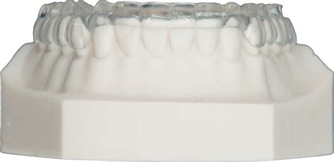 Tmj Splints Archives Protec Dental