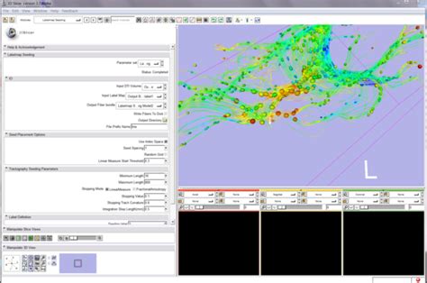 Modulesroiseeding Documentation 36 Slicer Wiki