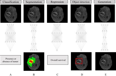 Quantifying Uncertainty In Deep Learning Of Radiologic Images Radiology