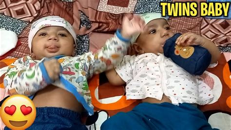 Twins Baby Kabhi Nhi Dekha Hoga Aise YouTube