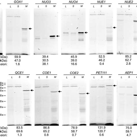 Colocalization Analysis Of Mitochondrial Proteins Cells Containing Gfp Download Scientific