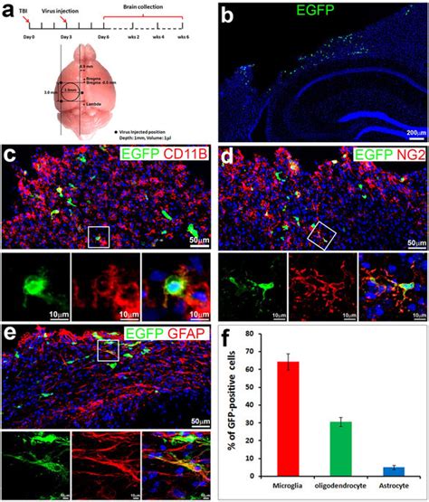 Retrovirus Infected Reactive Glia In Cortex Following Moderate