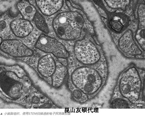 蔡司扫描电子显微镜生物样品成像方式及制备流程 行业资讯 工业ct 蔡司三坐标测量机 蔡司扫描电镜 昆山友硕新材料有限公司