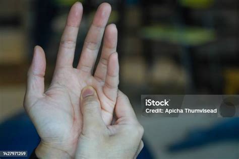 트리거 손가락 질환 고통스러운 부위에 하이라이트와 손 해부학 환자는 손바닥 통증과 손가락 문제를 잡는다 의학 증상 개념 손가락에 대한 스톡 사진 및 기타 이미지 Istock