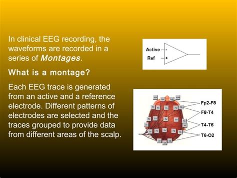 EEG Montages Equipment And Basic Physics PPT Chemistry Science