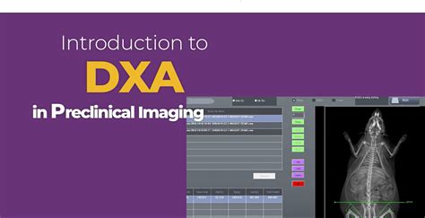 When To Consider Implementing Dxa Scintica