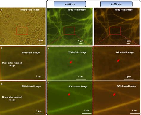 3d Dual Color Cellular Imaging A Bright Field And B C Wide Field Download Scientific Diagram