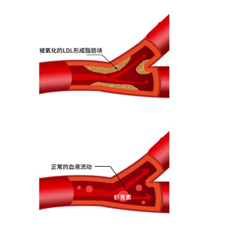 血管