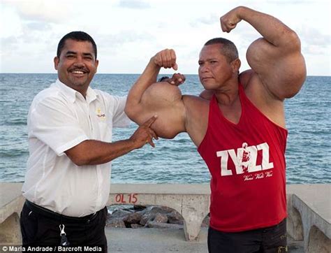Brazilian Bodybuilder Grows Inch Fake Biceps