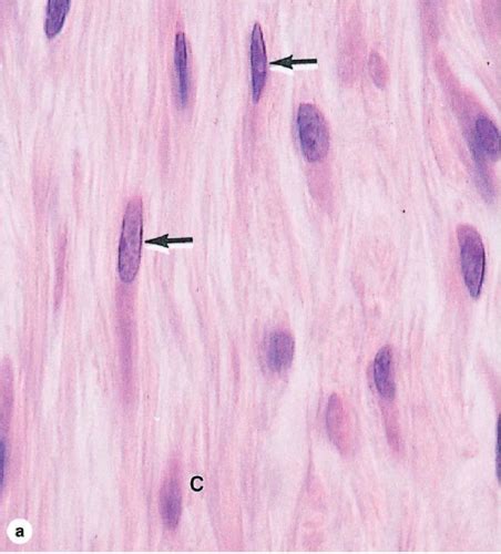 Connective Tissue Flashcards Quizlet