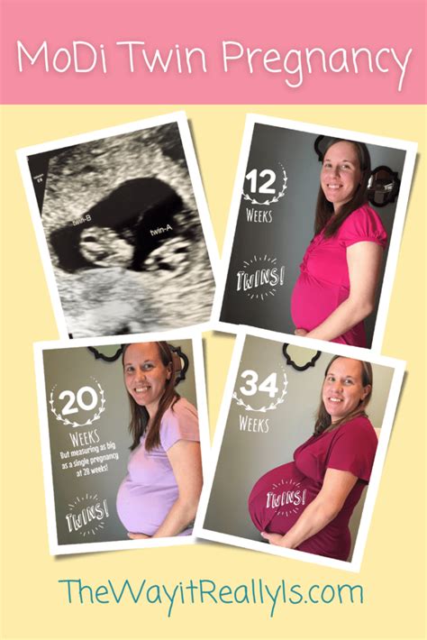 Step By Step Through A Modi Twin Pregnancy The Way It Really Is