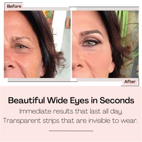 Eyelid Lifting Strips L 60 Pcs Kroger