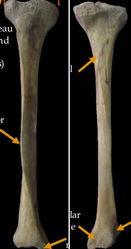 Tibia Diagram Quizlet