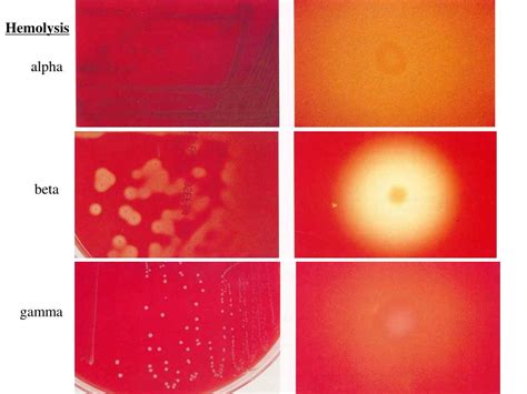 Ppt Pyogenic Coccus Powerpoint Presentation Free Download Id 3589406