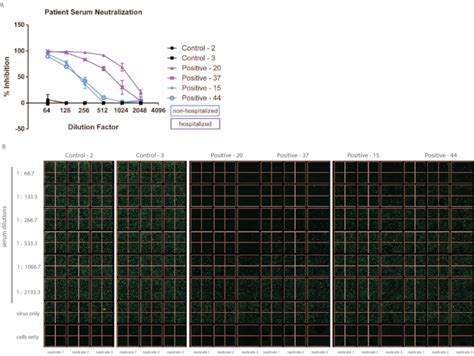 Detection Of Sars Cov 2 Neutralizing Antibodies Using High Throughput Fluorescent Imaging Of