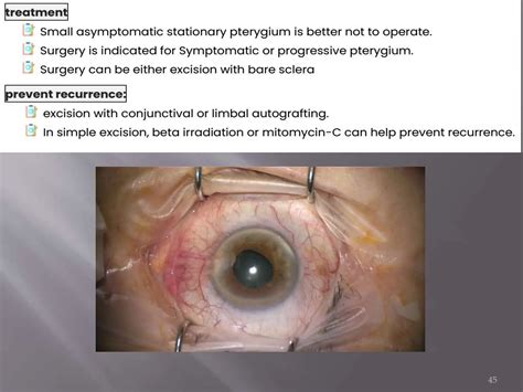 Conjunctiva Pptx