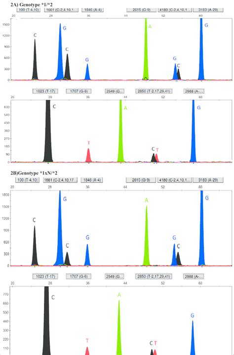 A Representative Electropherogram Of A Heterozygous Patient Without A Download Scientific