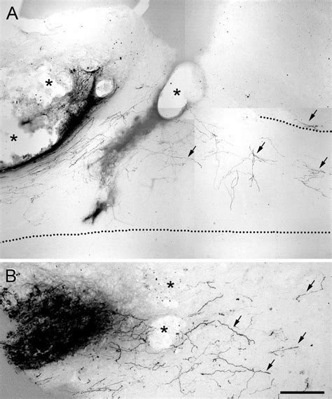 Two Examples Of Bda Labeled Corticospinal Fibers At The Lesion Site In