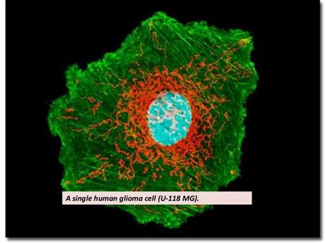 Glial Brain Tumor Cells A Picture Gallery