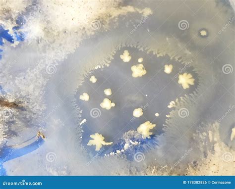 Aspergillus Niger Fungus And Bacillus Bacteria Growing On Sabouraud