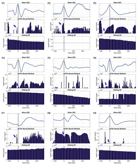 Mean EEG Data Top Plot From A Representative Channel Within The Download Scientific Diagram