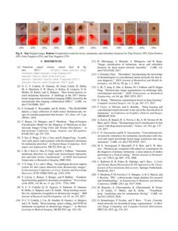 Skin Lesion Segmentation And Classification With Deep Learning System DeepAI