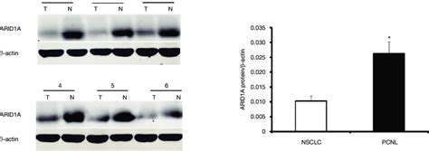 ARID1A Protein Level Was Analyzed By Western Blotting In NSCLC T And