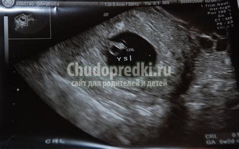 Узи 3 недели Все что необходимо знать