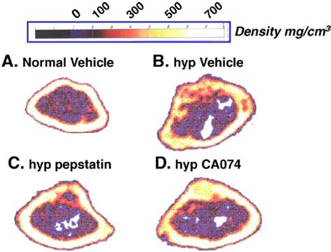 Figure 1 From Correction Of The Mineralization Defect In Hyp Mice