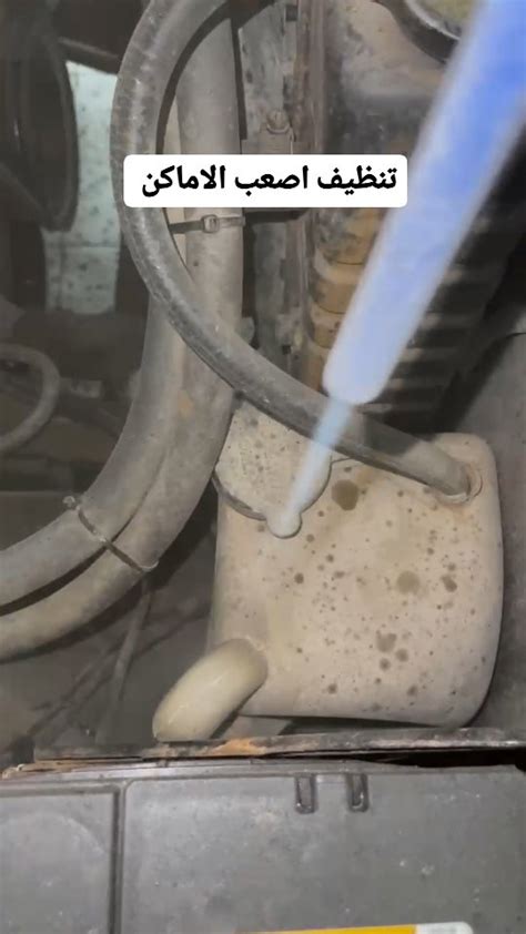 ‎dryice ️ Carbon⚡️laser 🇰🇼 دراي آيس كاربن ليزر‎ Dryicecarbonlaser